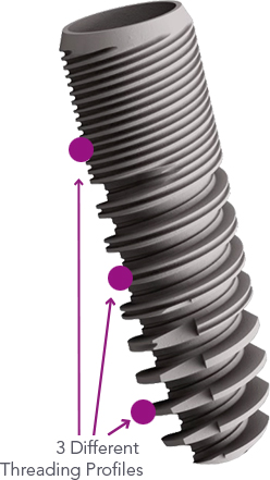 3 Different Threading Profiles | C-Tech Implant | Supply of dental ...