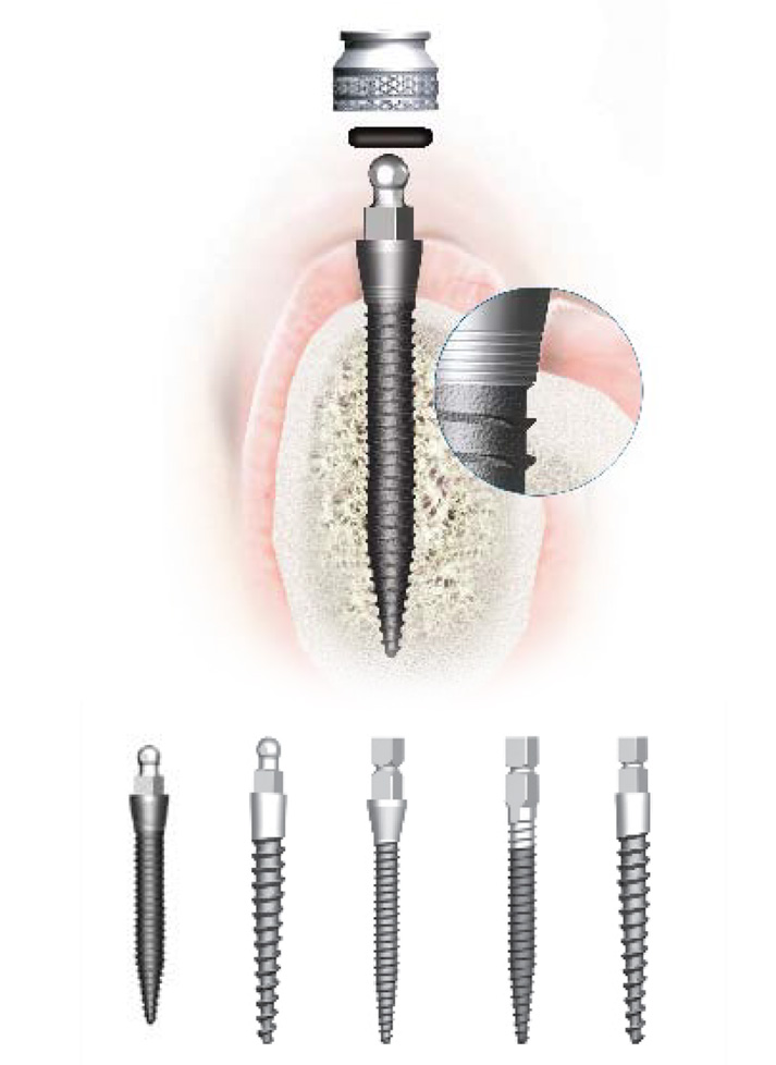 Implant Practice - February 2009 Volume 2 Number 1 - Minimal invasive ...