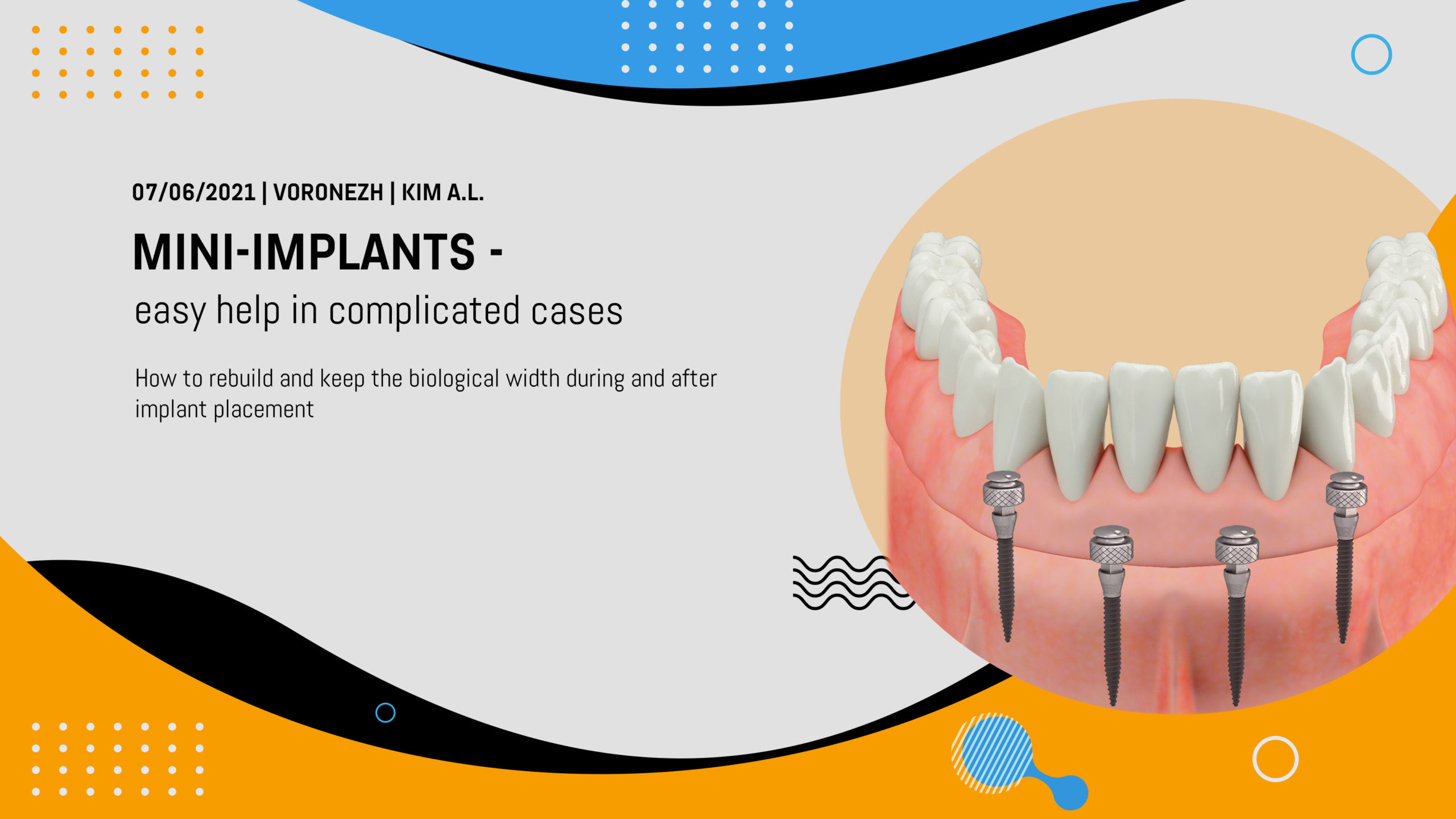 Fair | Dental Forum | How to make money using mini-implants. How to ...