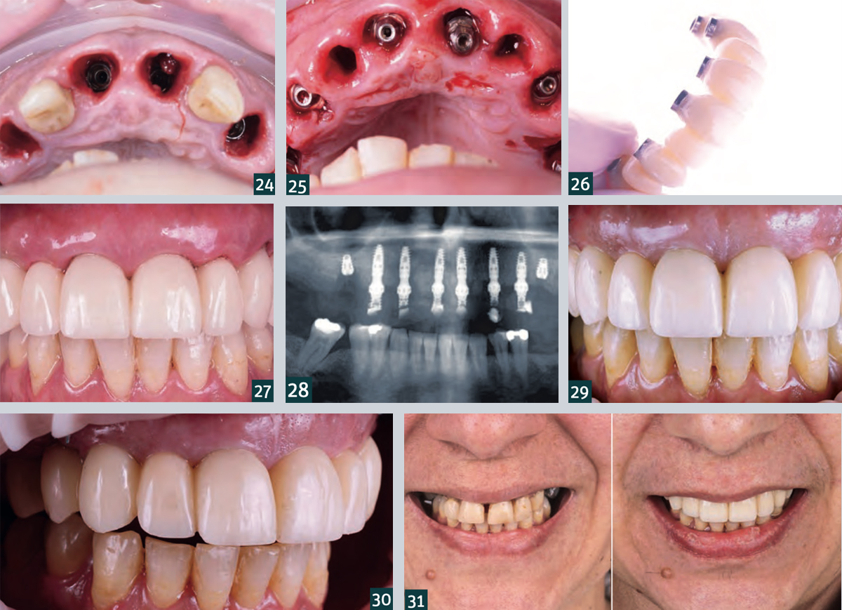 Testimonianza di Michael Weiland | Corsi teorici e pratici di ...